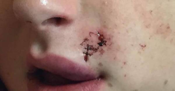 Disturbing Video Shows NJ Cops Tear Open Teen's Face for Not Giving ...