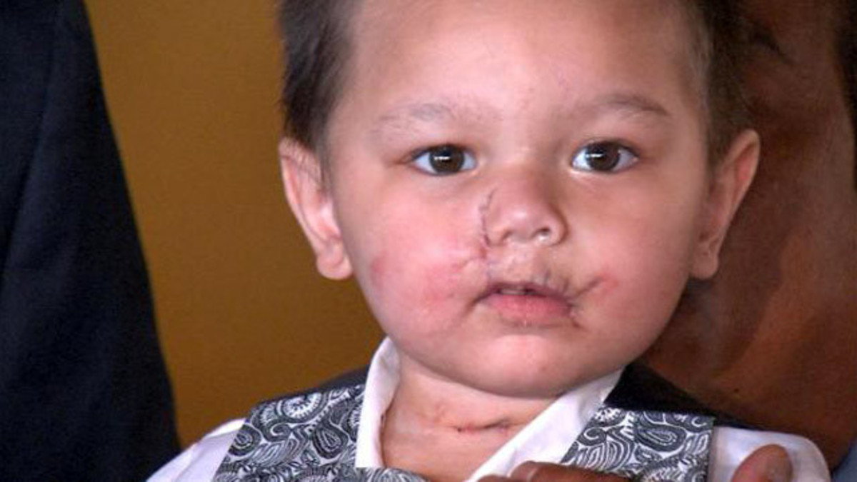 No Charges for Cops Who Disfigured Toddler with Grenade During ...