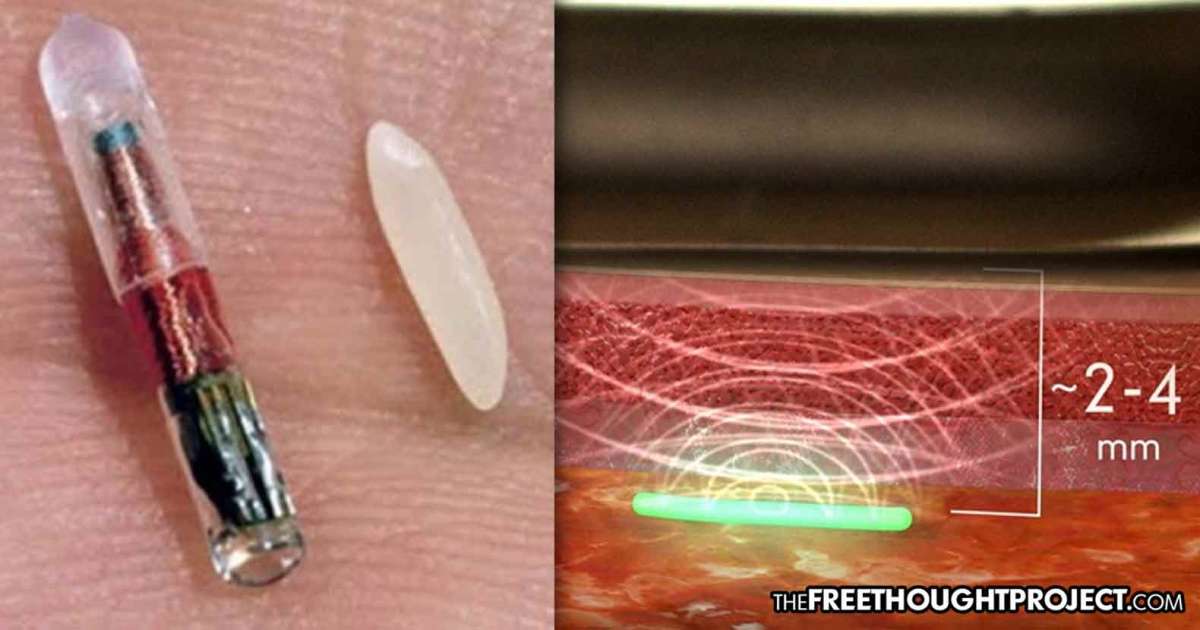 A DARPA-Funded Implantable Biochip to Detect COVID-19 Could Hit Markets ...