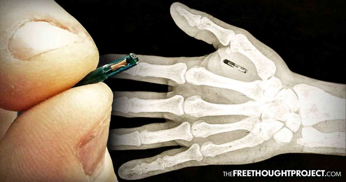 Lawmaker Proposes Implanting Microchips in People to Track Non-Violent ...