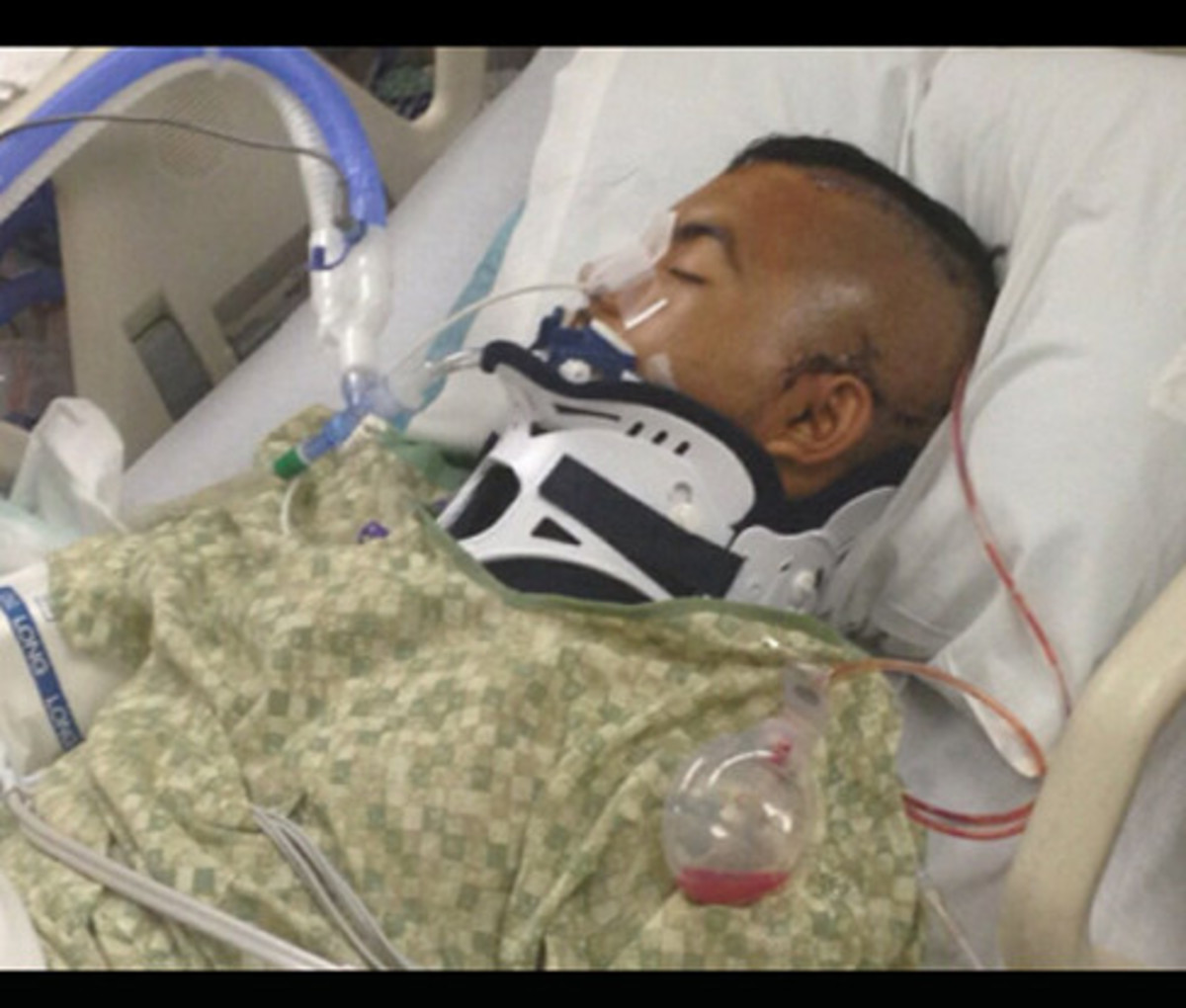 High School Student in Critical Condition After Being Tazed by Cops ...