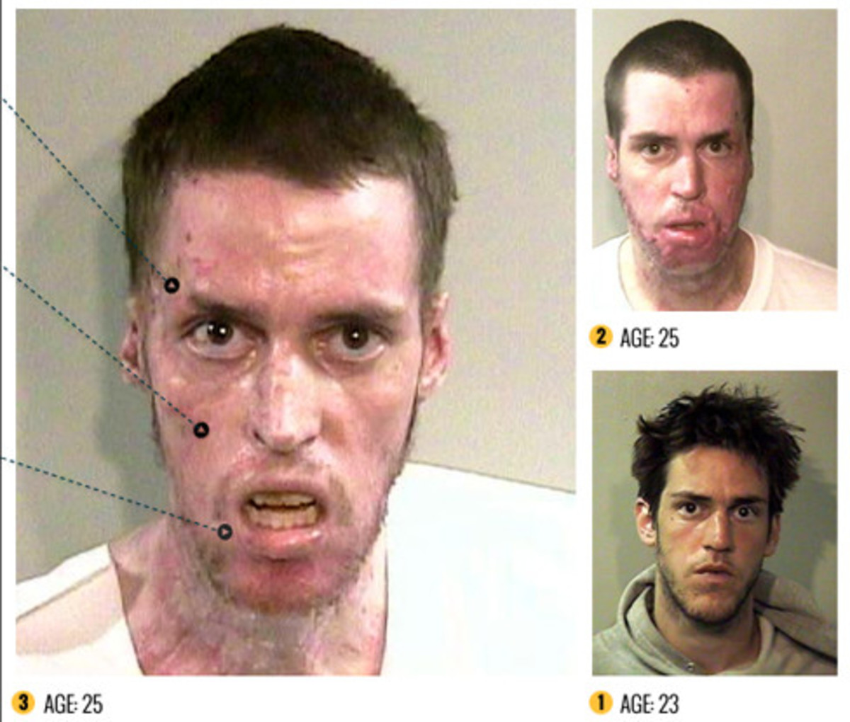 Faces of Meth: The Horrifying Reality of this Brutal Drug Addiction ...